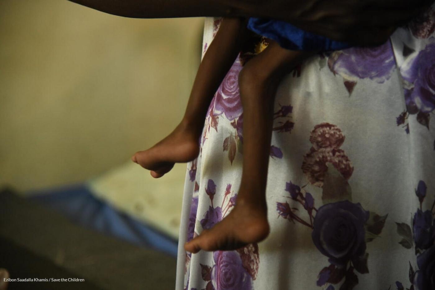 Carestia: le 10 cose da sapere | Save the Children